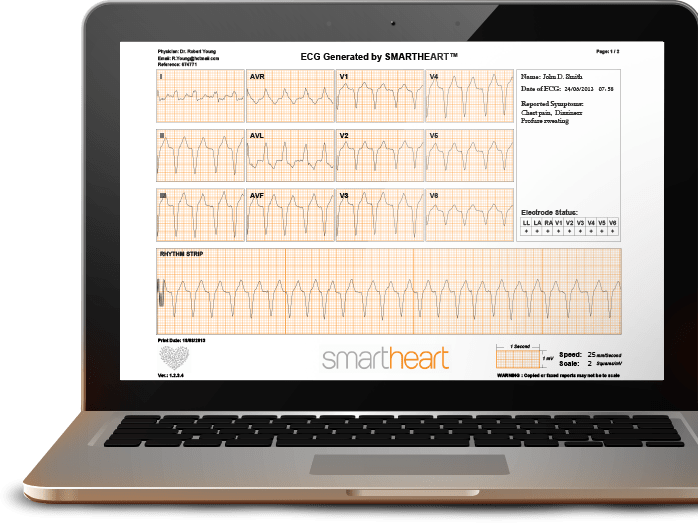 SmartHeart pro | סמארטהארט פרו לרופאים | שחל